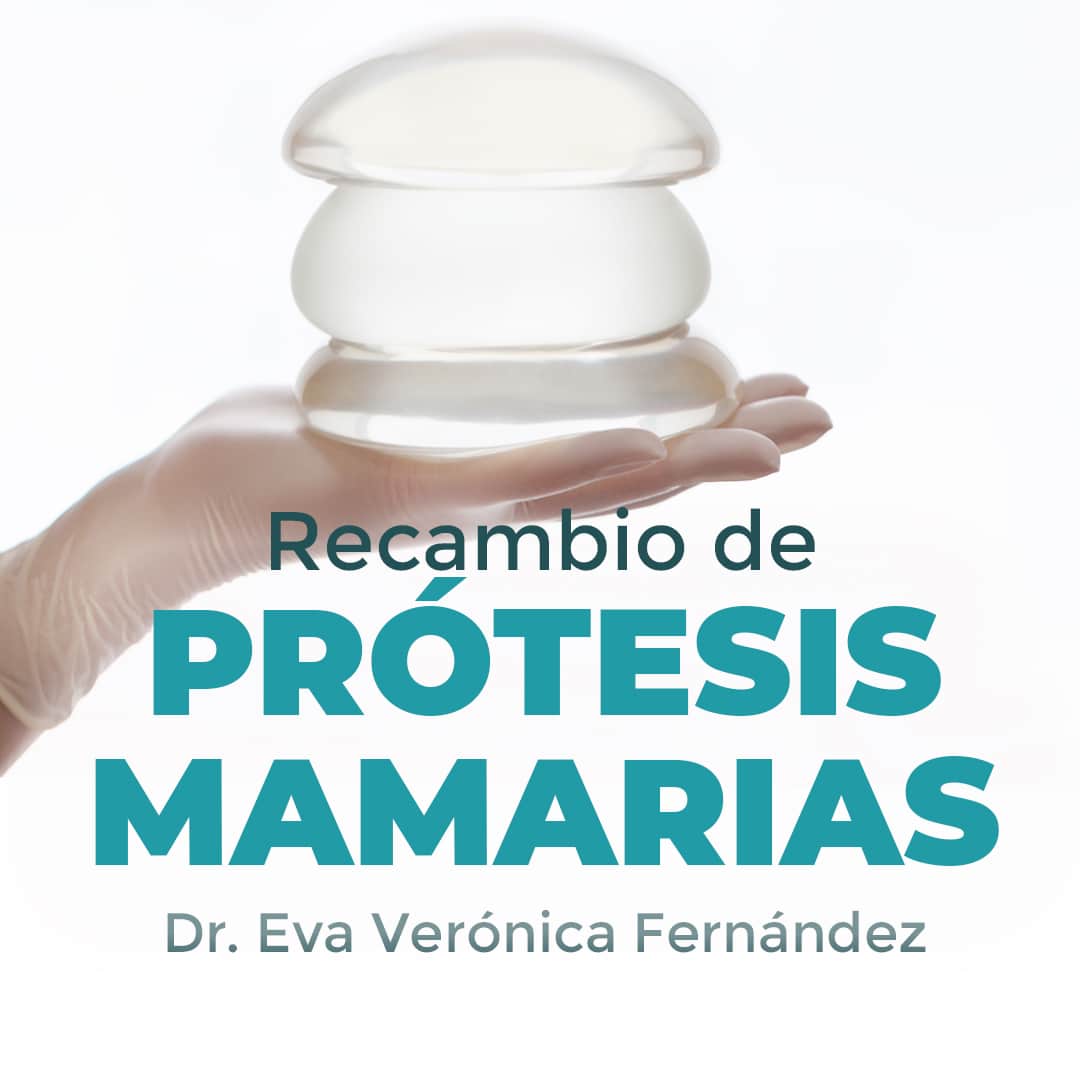 RECAMBIO PRÓTESIS DE MAMA - Aumento de Pecho Madrid | Cirugía plástica